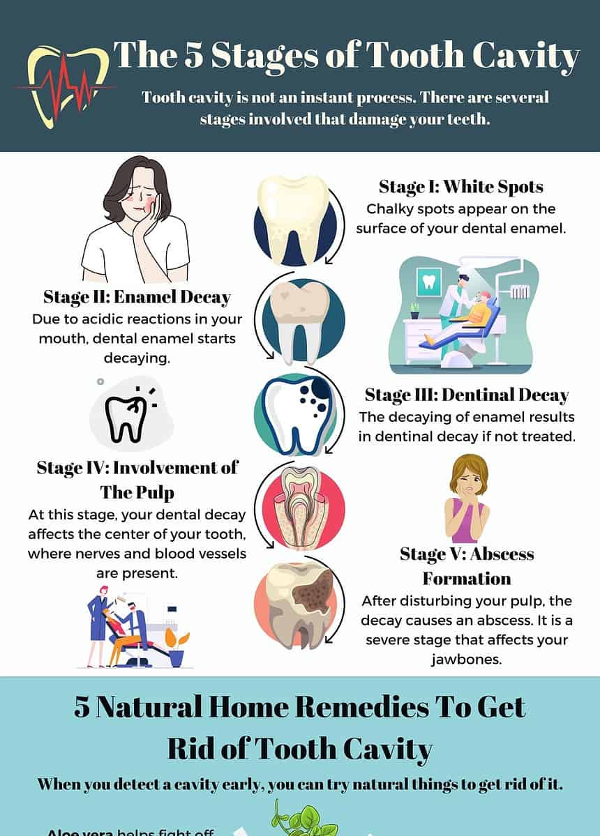 Can You Reverse A Cavity: 5 Most Effective Treatments - Icy Health