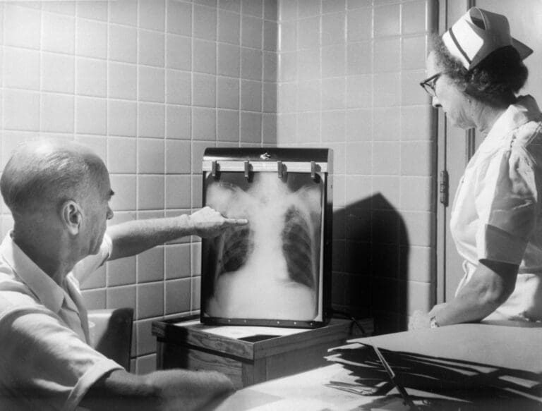 How To Prevent Tuberculosis: 8 Essential Methods - Icy Health
