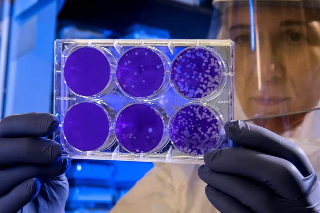 Stem Cells 8 Important Things To Know stem-cells-8-important-things-to-know