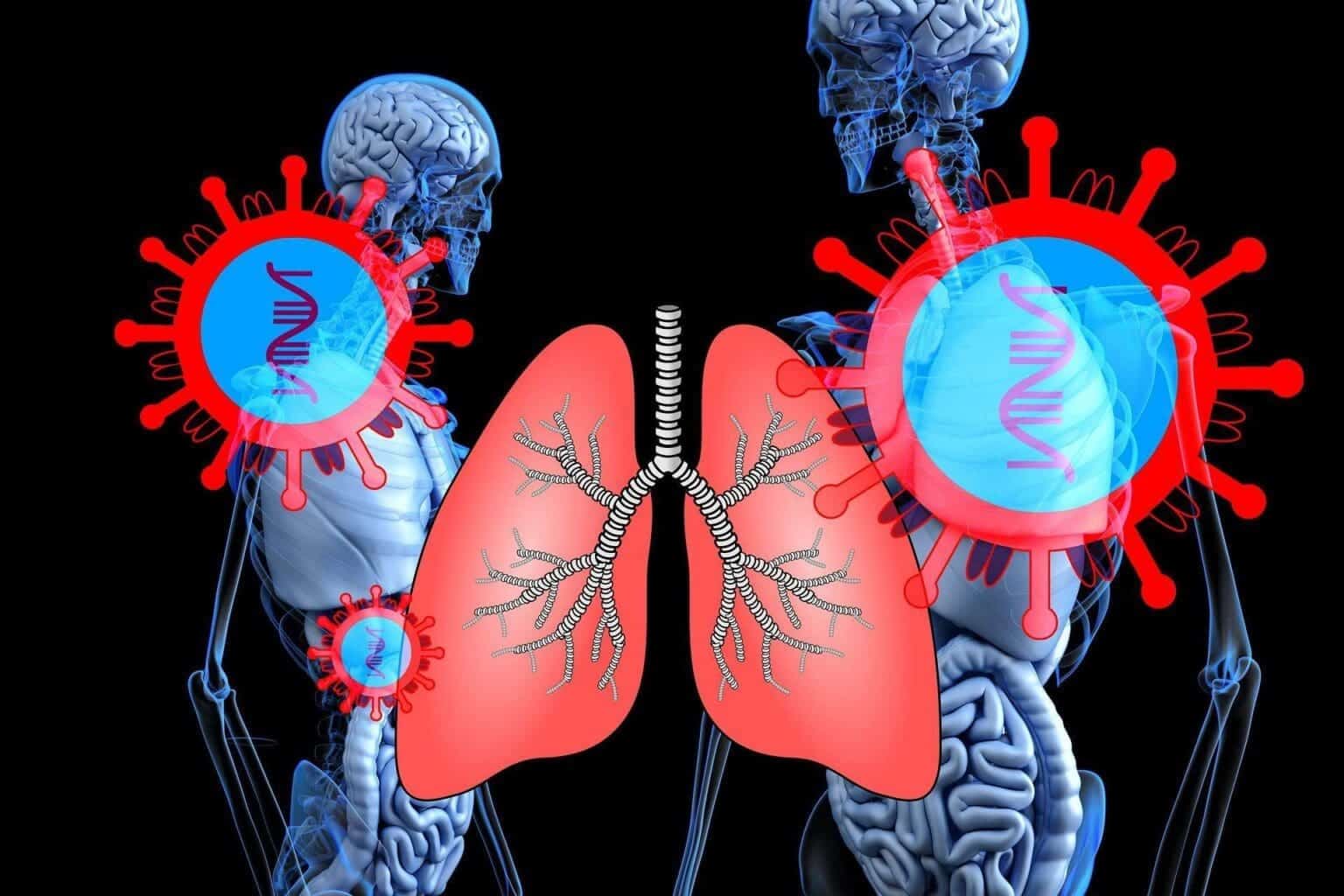 How Acute Coronary Syndrome Affects The Body