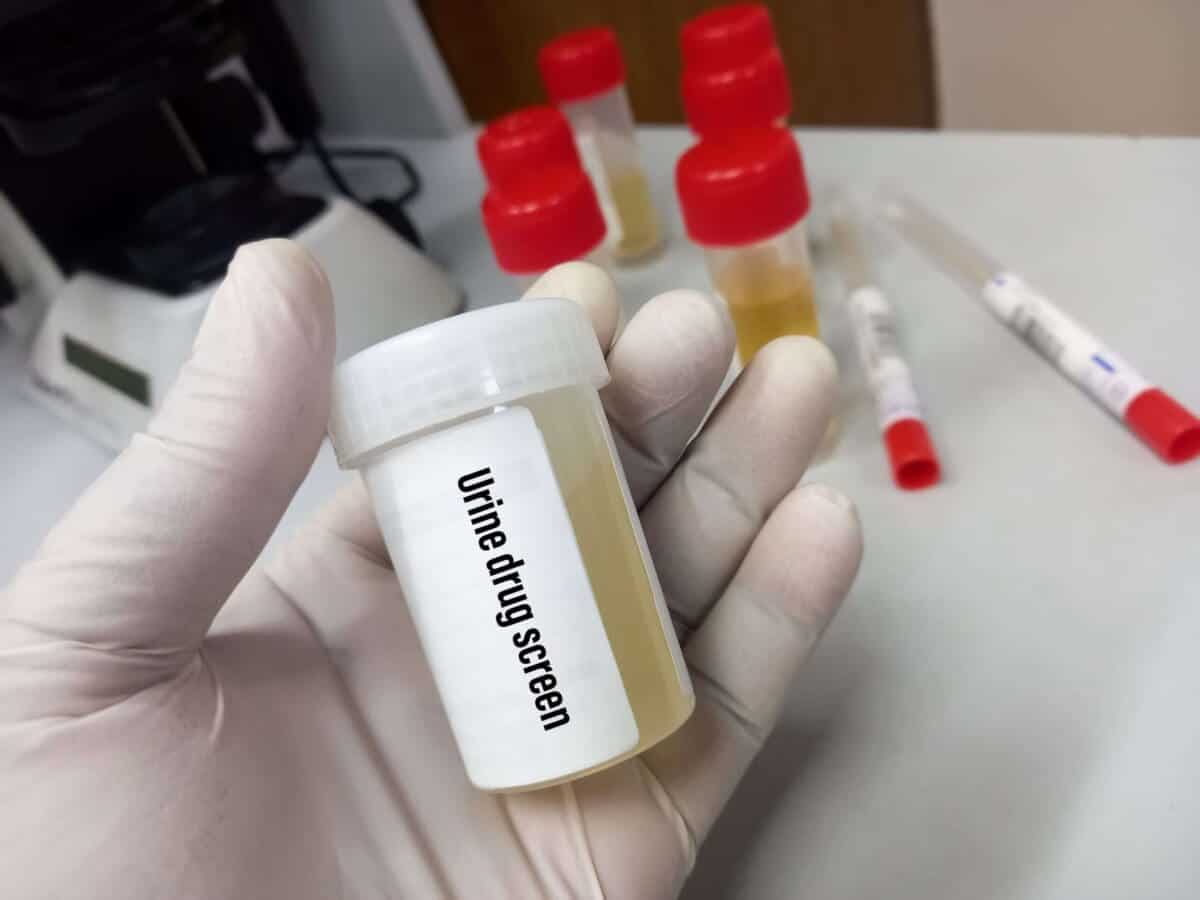 What Is A Drug Screening: Understanding Common Types