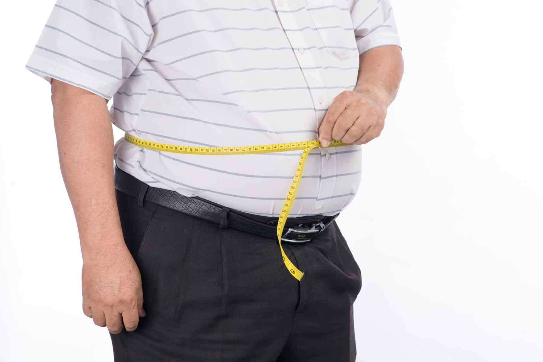 What Is Morbid Obesity: 7 Key Points To Know