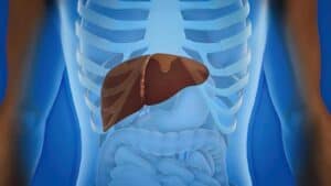 What is an Inflamed Liver? 3 Best Treatments - Icy Health