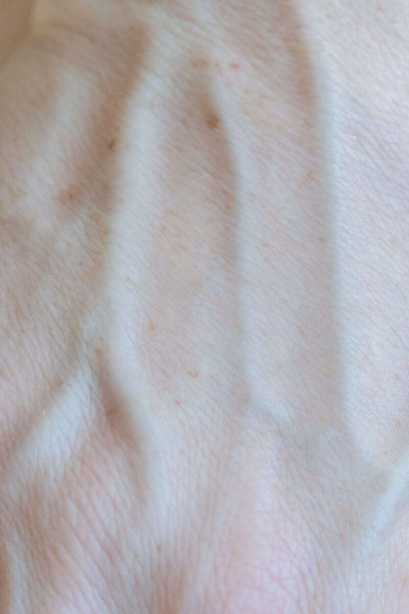 Visible Veins: Causes And Should You Be Concerned?