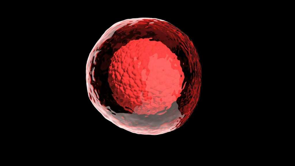 How Is Sickle Cell Anaemia Diagnosed: 4 Best Treatments
