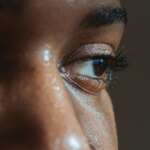 Why Is My Nose Red? Causes And Treatment For Better Skin