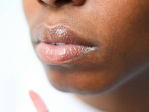 Inflamed Taste Buds: 8 Ways To Soothe Discomfort
